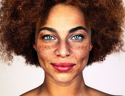 Why Do We Have Freckles On Our Face? - Frolicious | Deine Afro Haare ...