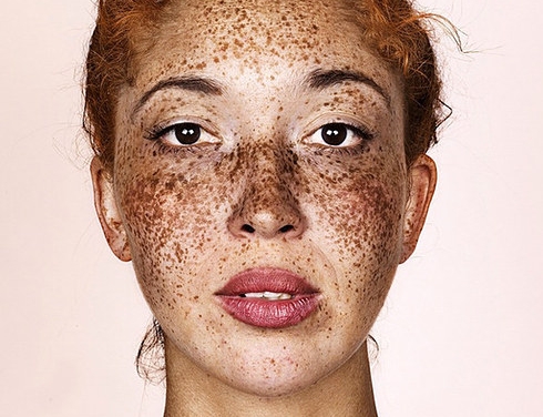 Why Do We Have Freckles On Our Face? - Frolicious | Deine Afro Haare ...
