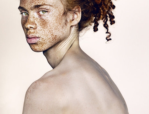 Why Do We Have Freckles On Our Face? - Frolicious | Deine Afro Haare ...