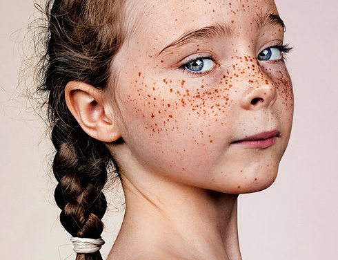 Why Do We Have Freckles On Our Face? - Frolicious | Deine Afro Haare ...